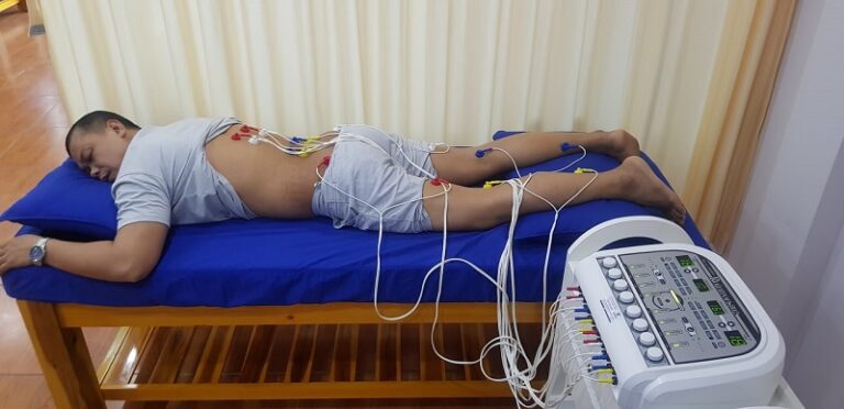 Chỉ định và quy trình điện châm điều trị đau thần kinh tọa